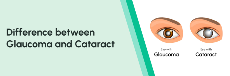 Cataracts vs Glaucoma: What Are the Differences?
