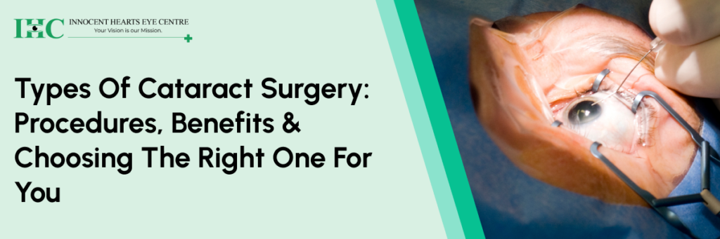 Types of Cataract Surgery: Procedures, Benefits & Choosing the Right ...